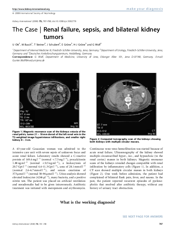(PDF) The Case ∣ Renal failure, sepsis, and bilateral kidney tumors