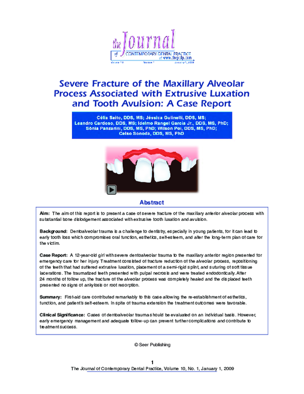 (PDF) Severe Fracture of the Maxillary Alveolar Process Associated with ...