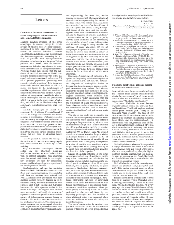 (PDF) Dihydrate birefringent calcium oxalate or Weddellite calcification