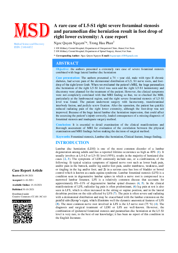 (PDF) A rare case of L5-S1 right severe foraminal stenosis and ...