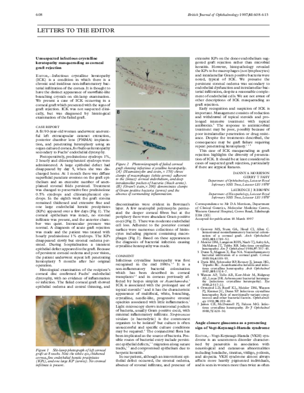 (PDF) Capsular bag distension syndrome