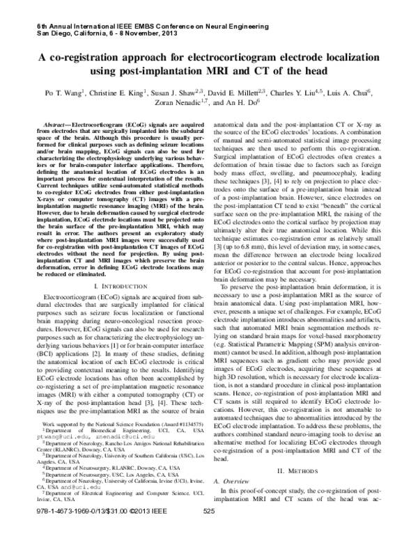 (PDF) A co-registration approach for electrocorticogram electrode localization using post ...