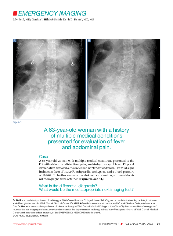 (PDF) Emergency Imaging