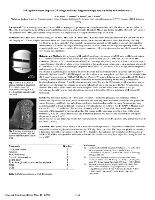 (PDF) MRI-guided breast biopsy at 3T using a dedicated large core ...