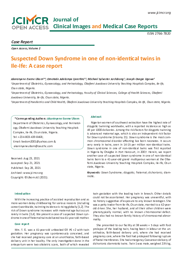 (PDF) Suspected Down Syndrome in one of non-identical twins in Ile-Ife ...