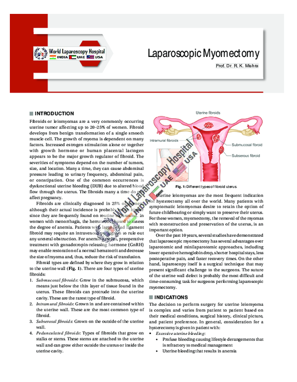 (PDF) Laparoscopic Myomectomy: A Minimally Invasive Solution for Uterine Fibroids