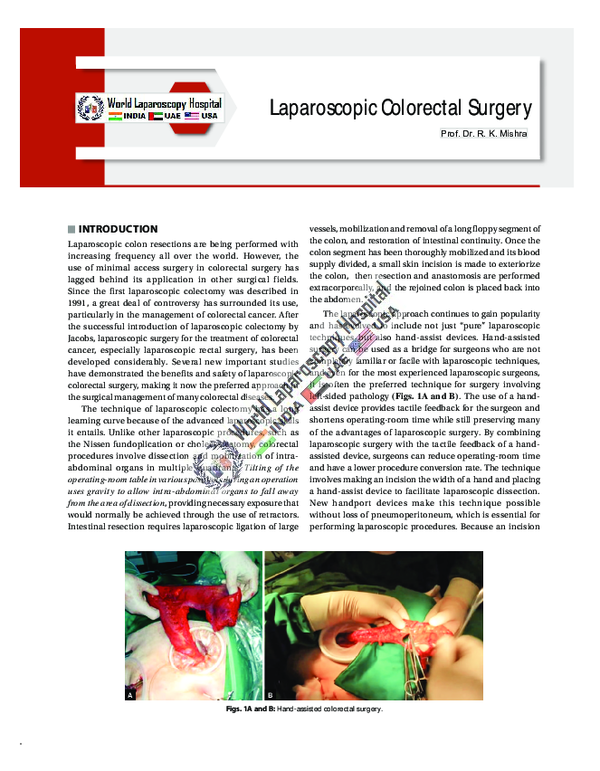 (PDF) Laparoscopic Colorectal Surgery: Advancements in Minimally Invasive Treatment of ...