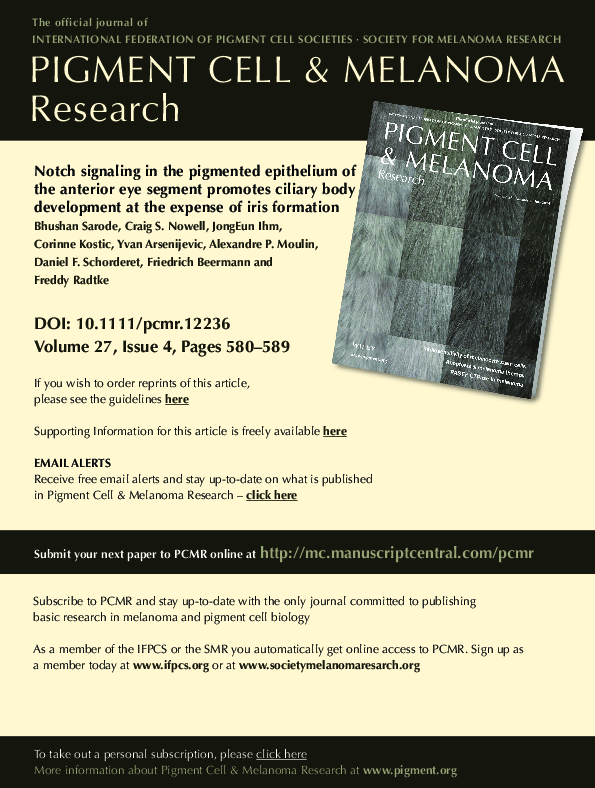(PDF) Notch signaling in the pigmented epithelium of the anterior eye ...