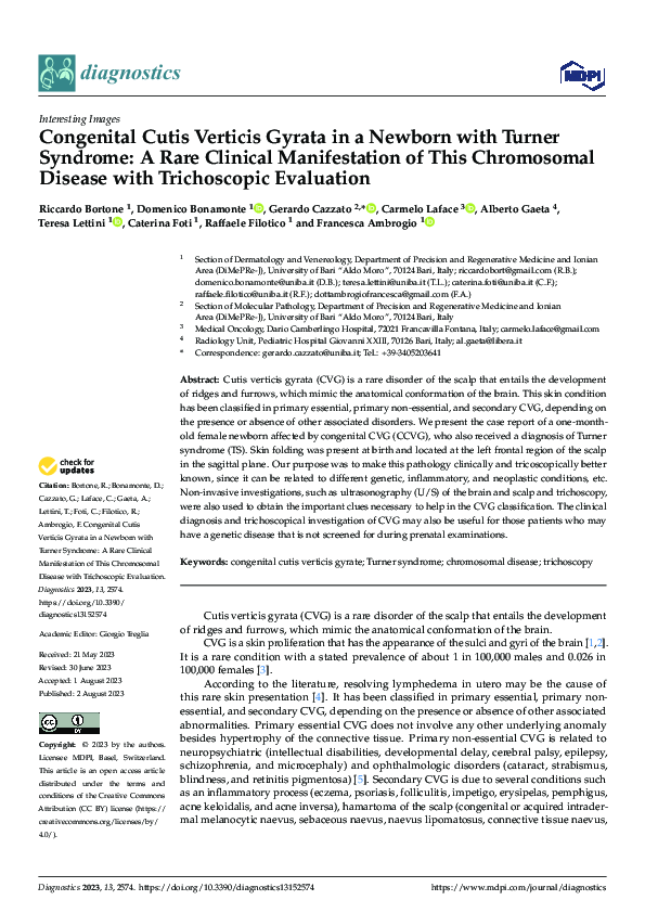 (PDF) Congenital Cutis Verticis Gyrata in a Newborn with Turner ...