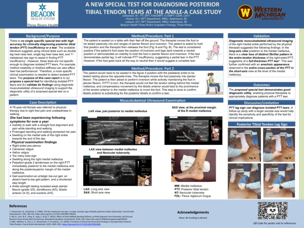 (PPT) A New Special Test For Diagnosing Posterior Tibial Tendon Tears ...