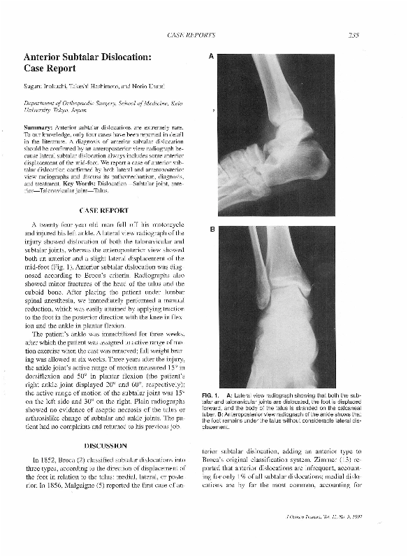 Pdf Anterior Subtalar Dislocation Case Report