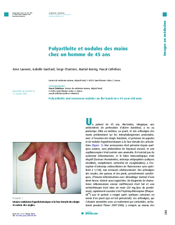 (PDF) Polyarthrite et nodules des mains chez un homme de 45 ans