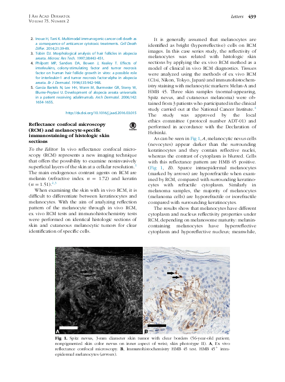 (PDF) Reflectance confocal microscopy (RCM) and melanocyte-specific ...