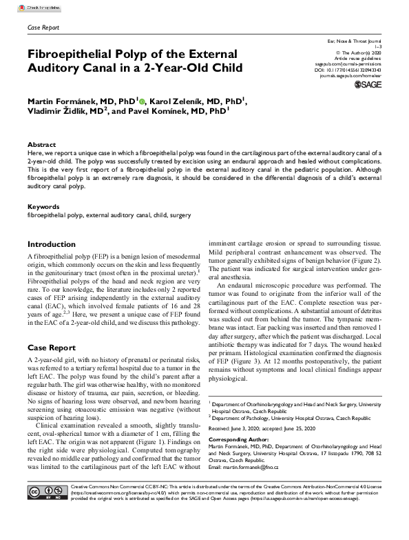 (PDF) Fibroepithelial Polyp of the External Auditory Canal in a 2-Year ...