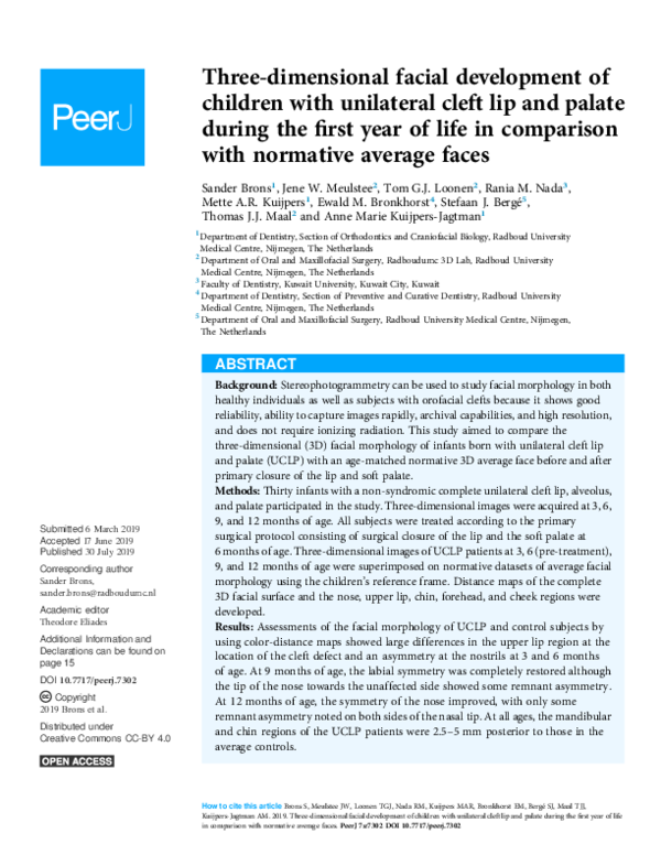 (PDF) Three-dimensional facial development of children with unilateral ...