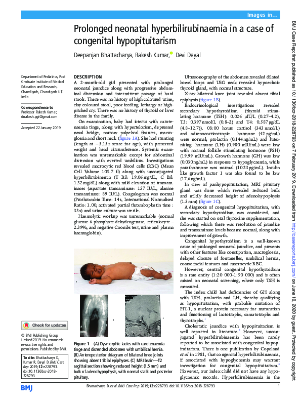 (PDF) Prolonged neonatal hyperbilirubinaemia in a case of congenital ...