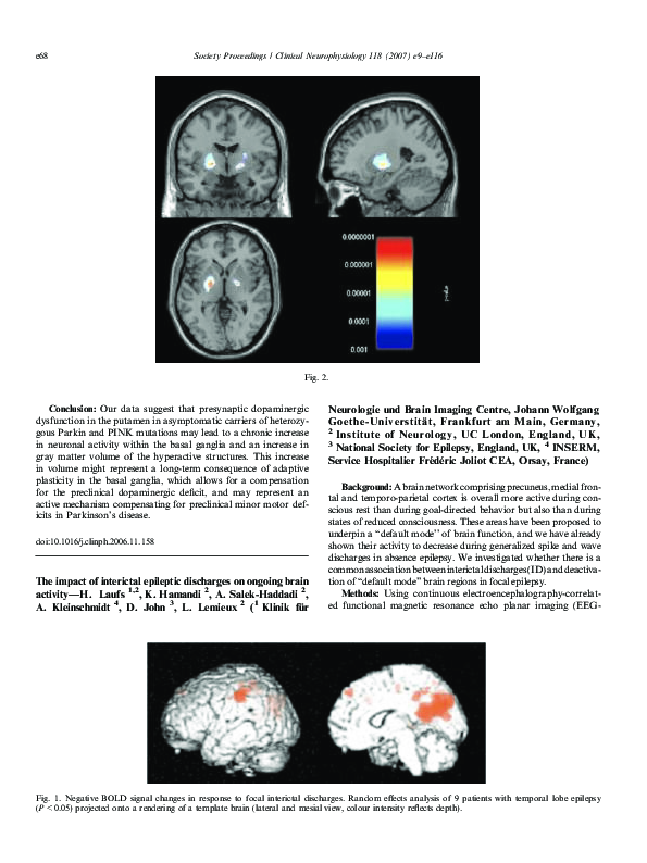 (PDF) The impact of interictal epileptic discharges on ongoing brain ...