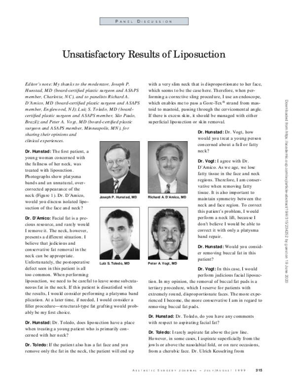 (PDF) Unsatisfactory Results of Liposuction