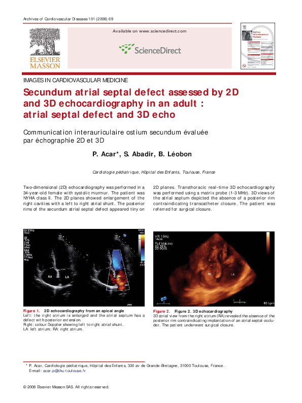 (PDF) Secundum atrial septal defect assessed by 2D and 3D ...