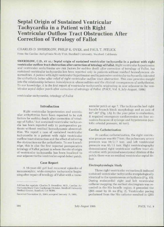 (PDF) Ventricular Tachycardia Post Tetralogy of Fallot