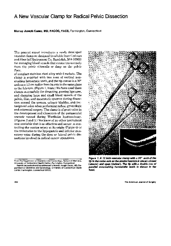 (PDF) A new vascular clamp for radical pelvic dissection | Murray Casey ...