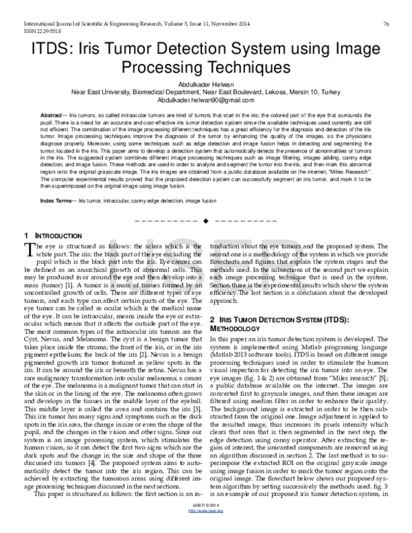 (PDF) ITDS: Iris Tumor Detection System using Image Processing Techniques