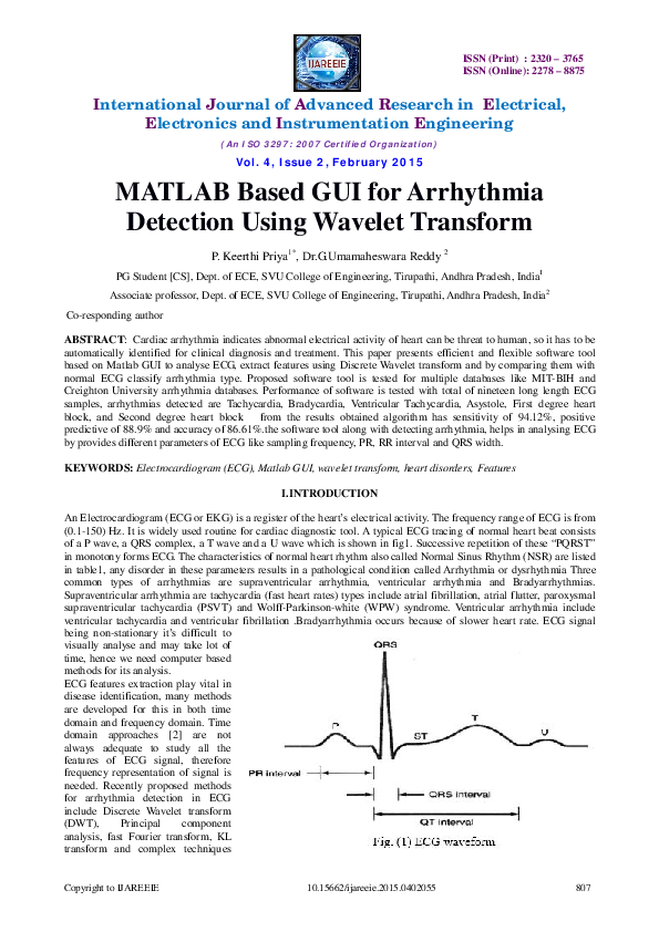 Pdf Arrhythmia Detection Using Wavelet Transform