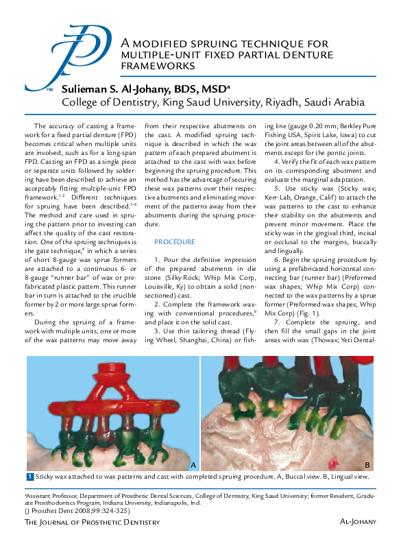 (PDF) A modified spruing technique for multiple-unit fixed partial ...