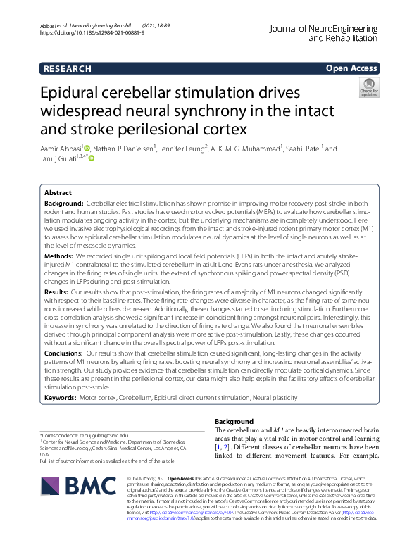 (PDF) Epidural cerebellar stimulation drives widespread neural synchrony in the intact and ...