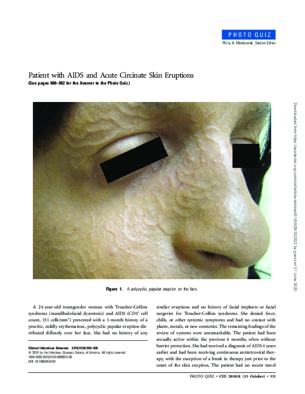 (PDF) Patient with AIDS and Acute Circinate Skin Eruptions | Erin Boh ...