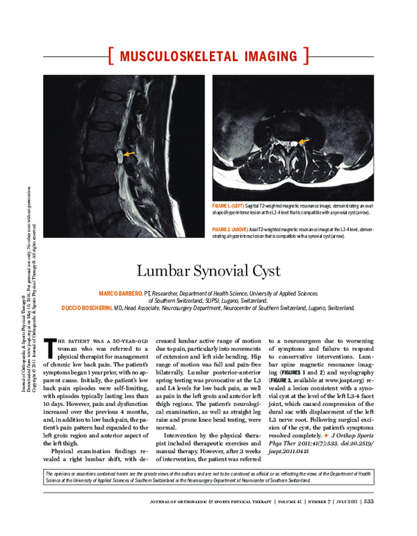 (PDF) Lumbar Synovial Cyst