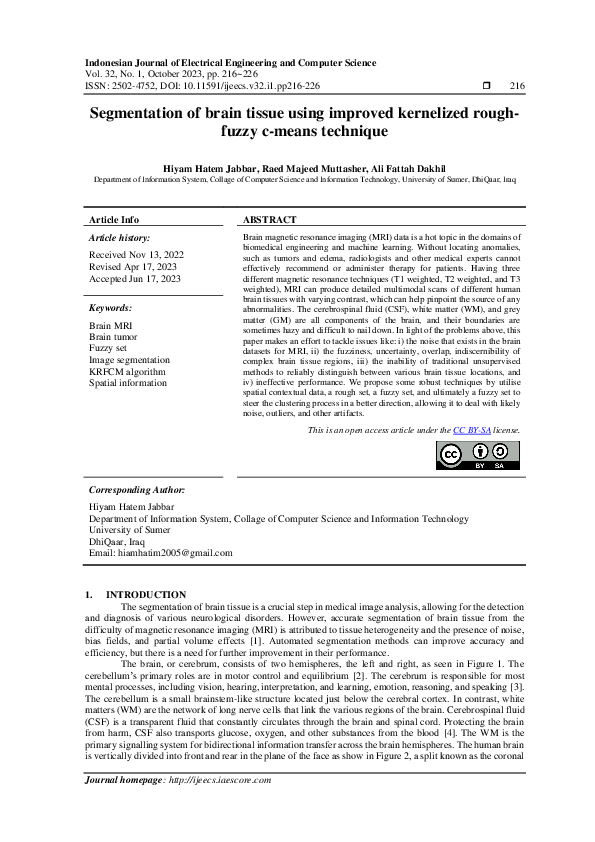 Pdf Segmentation Of Brain Tissue Using Improved Kernelized Roughfuzzy