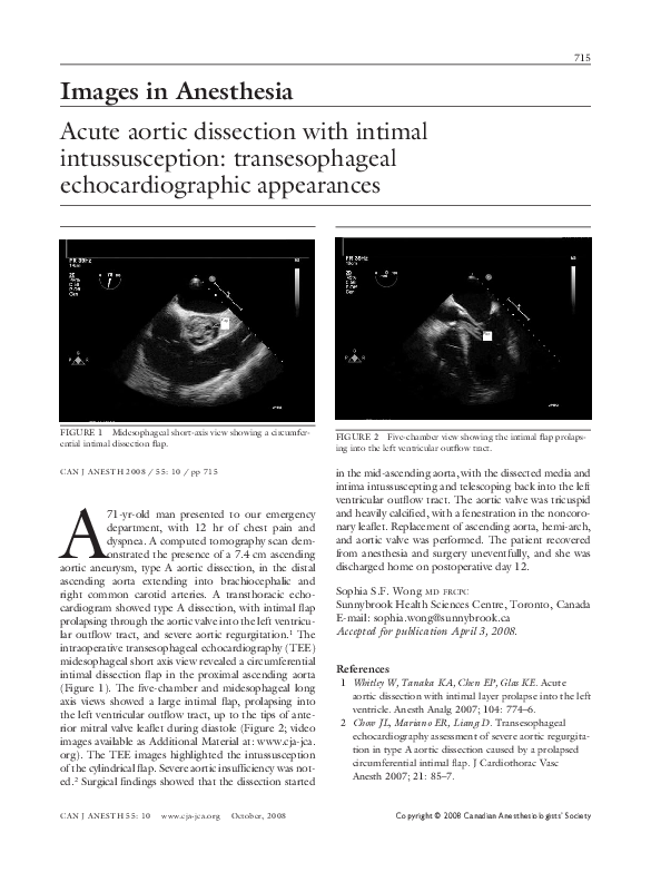 (PDF) Acute aortic dissection with intimal intussusception ...
