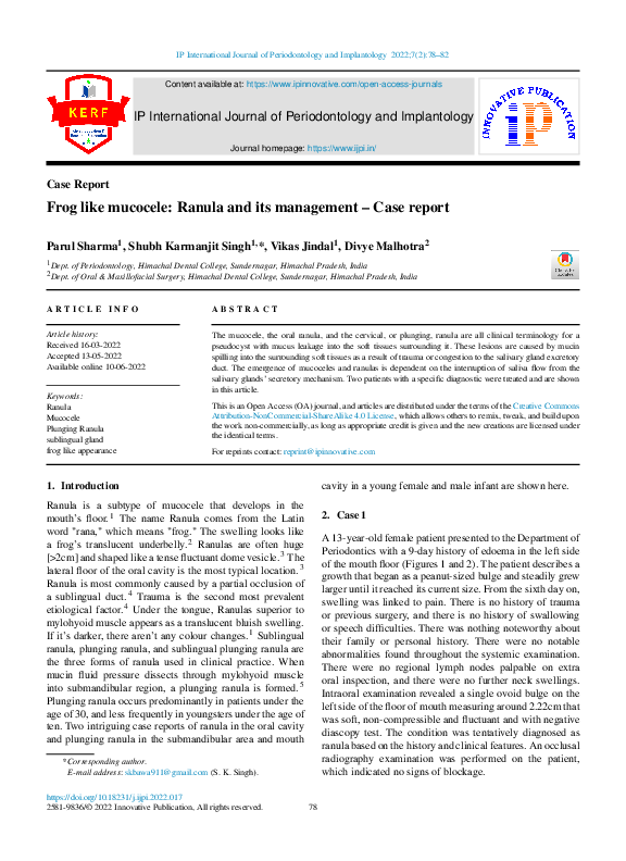 (PDF) Frog like mucocele: Ranula and its management – Case report