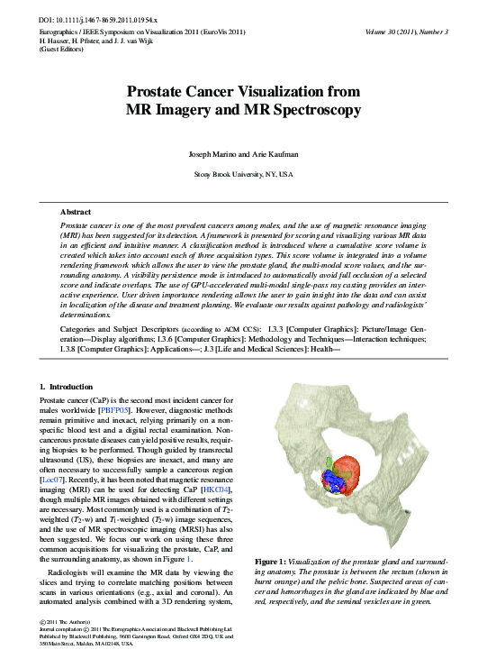 (PDF) Prostate Cancer Visualization from MR Imagery and MR Spectroscopy