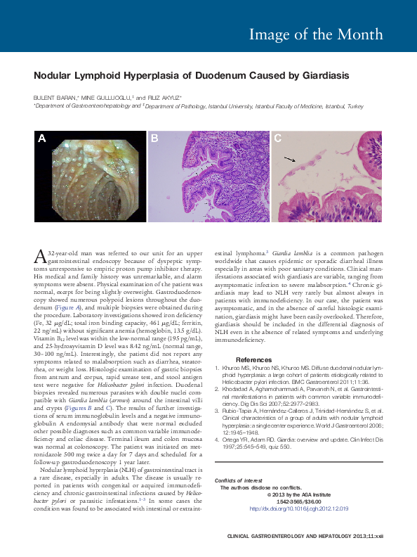 (PDF) Nodular Lymphoid Hyperplasia of Duodenum Caused by Giardiasis
