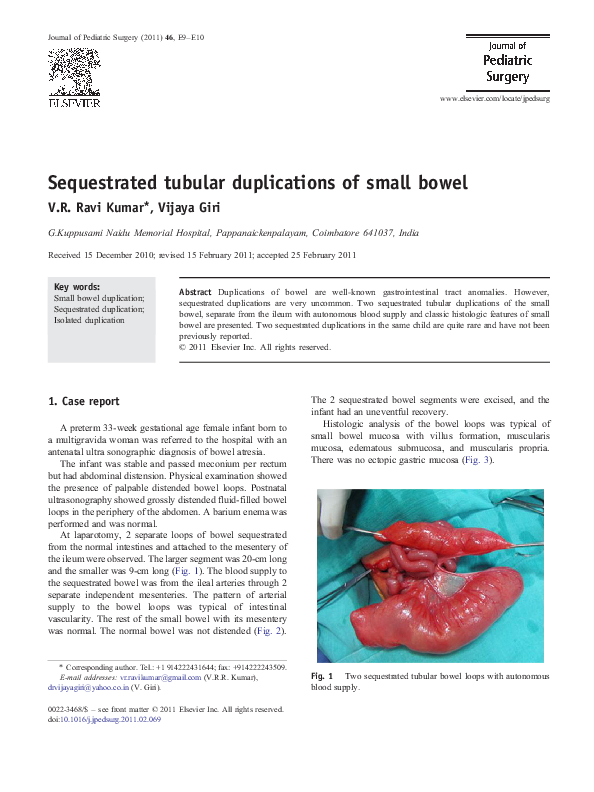 (PDF) Sequestrated tubular duplications of small bowel