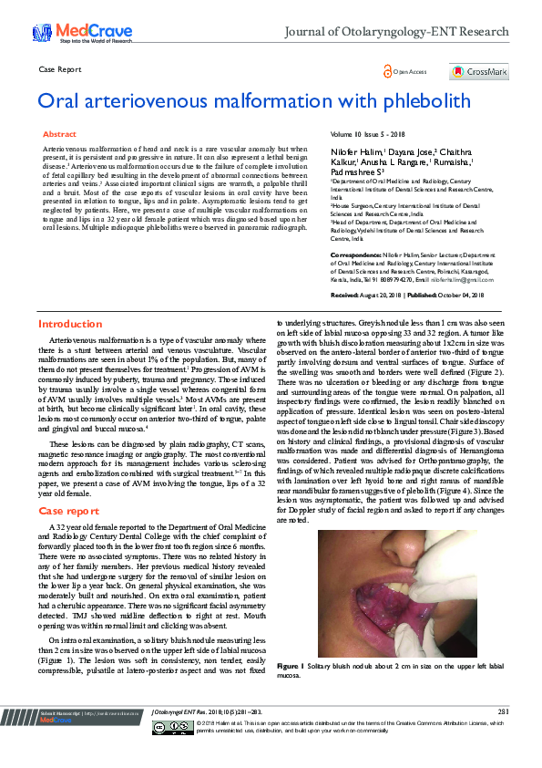 (PDF) Oral arteriovenous malformation with phlebolith