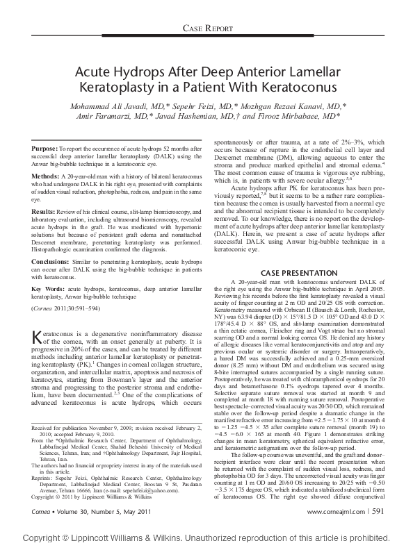 (PDF) Acute Hydrops After Deep Anterior Lamellar Keratoplasty in a ...