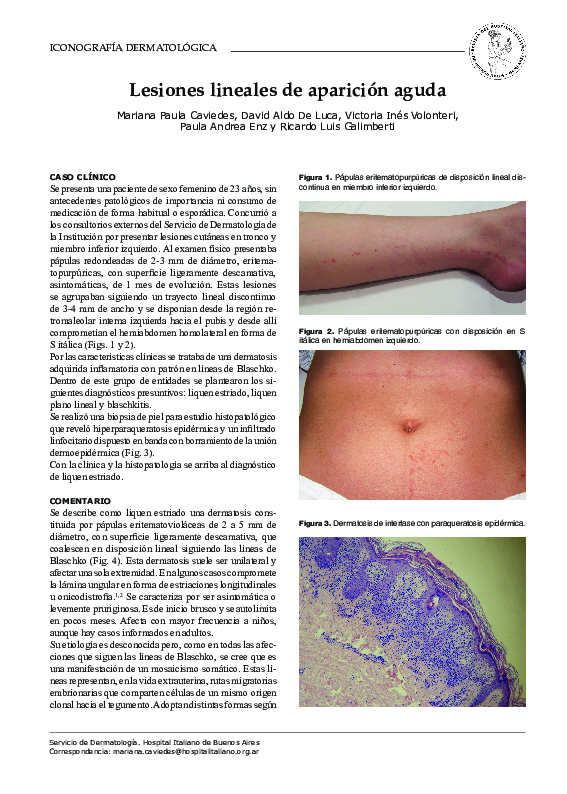 (PDF) Lesiones lineales de aparición aguda