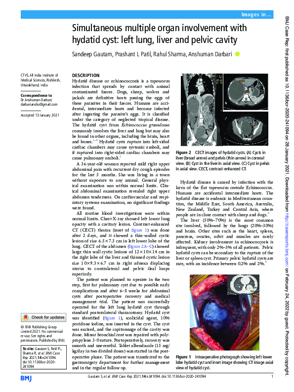 (PDF) Simultaneous multiple organ involvement with hydatid cyst: left ...