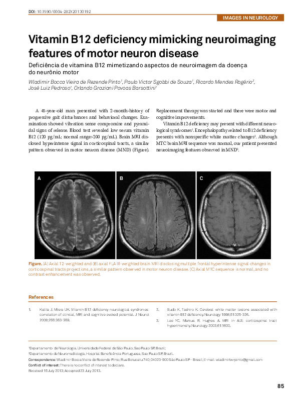 (PDF) Vitamin B12 deficiency mimicking neuroimaging features of motor neuron disease