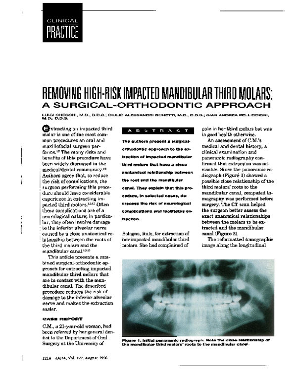 (PDF) Removing High-Risk Impacted Mandibular Third Molars: A Surgical ...
