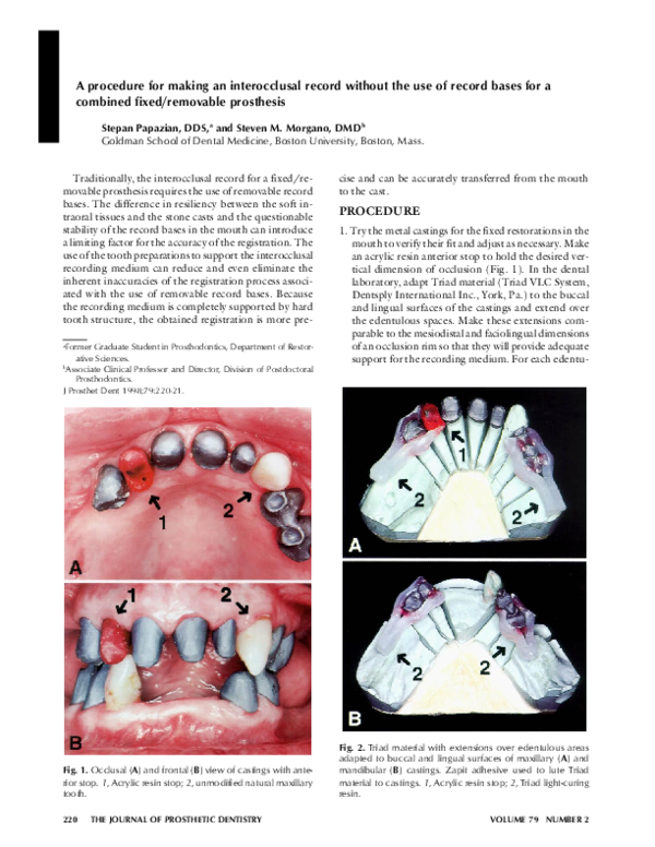 (PDF) A procedure for making an interocclusal record without the use of ...