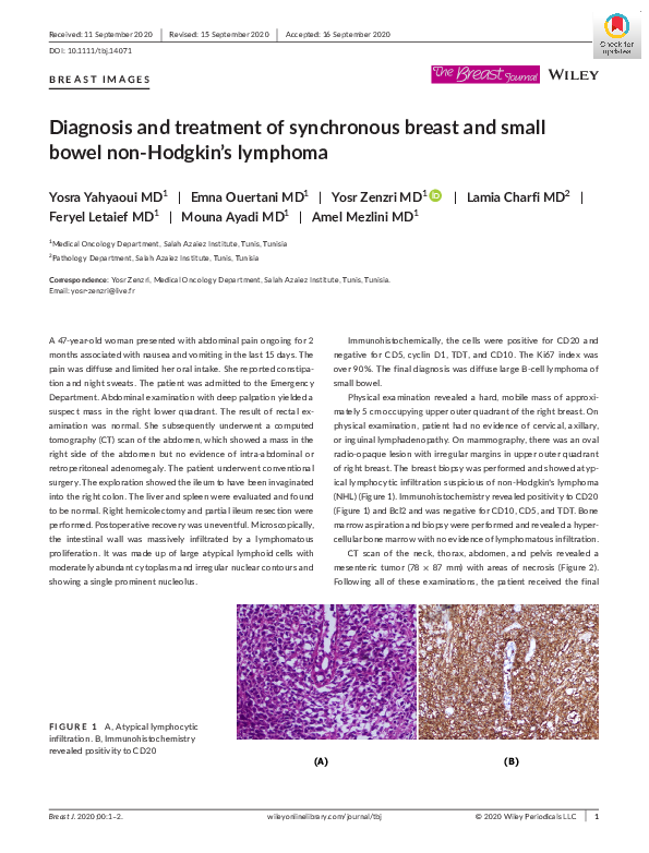 (PDF) Diagnosis and treatment of synchronous breast and small bowel non‐Hodgkin’s lymphoma
