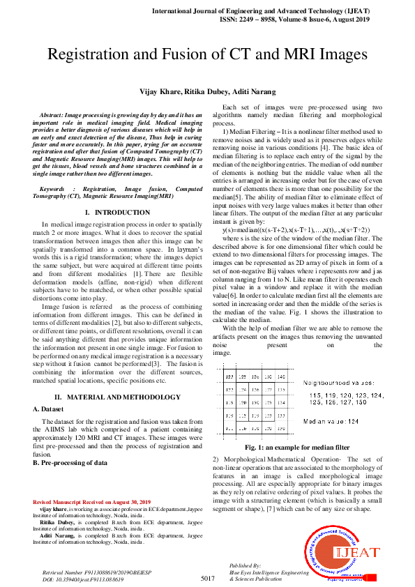(PDF) Registration and Fusion of CT and MRI Images