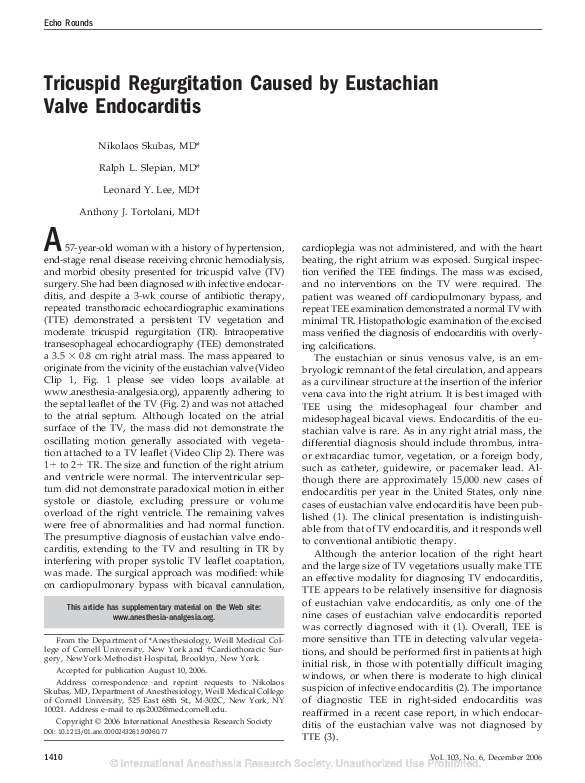 (PDF) Placement of the TandemHeart® Percutaneous Left Ventricular ...