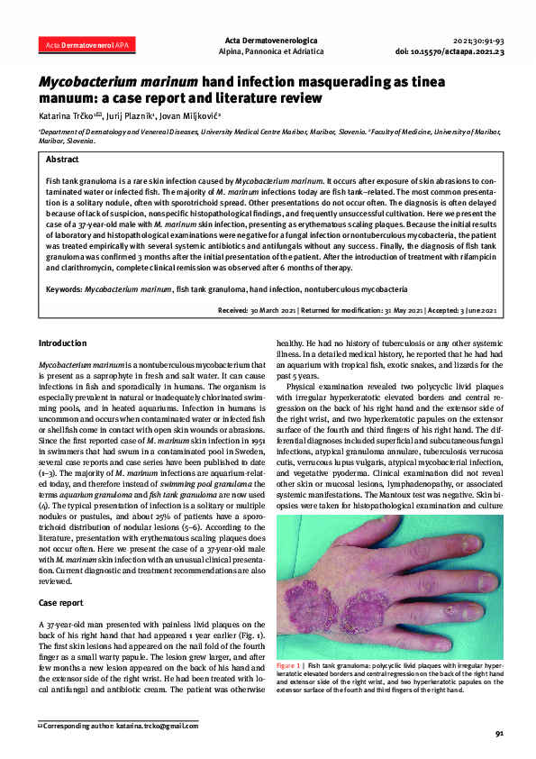 (PDF) Mycobacterium marinum hand infection masquerading as tinea manuum ...