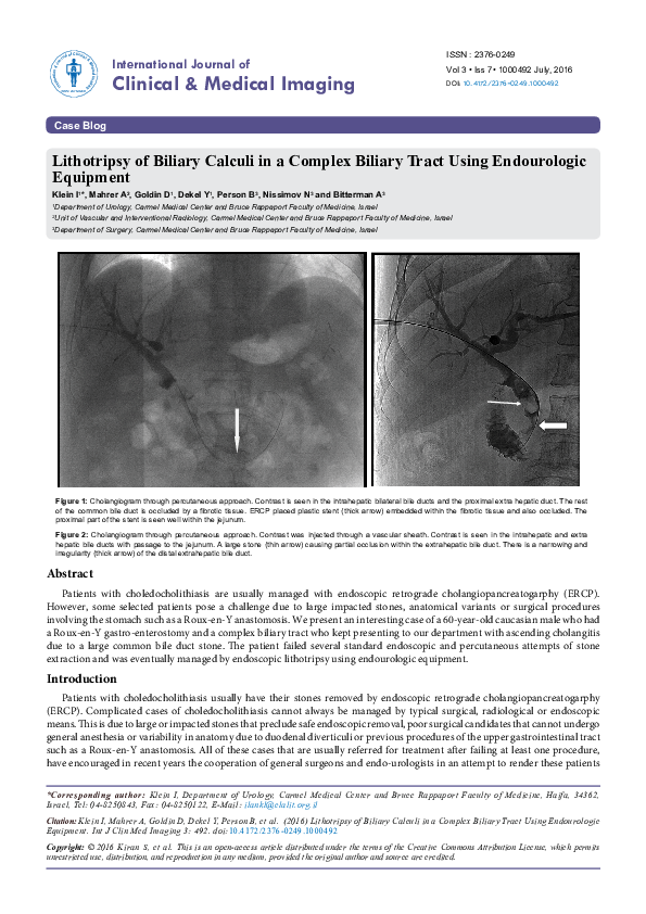 (PDF) Lithotripsy of Biliary Calculi in a Complex Biliary Tract Using ...