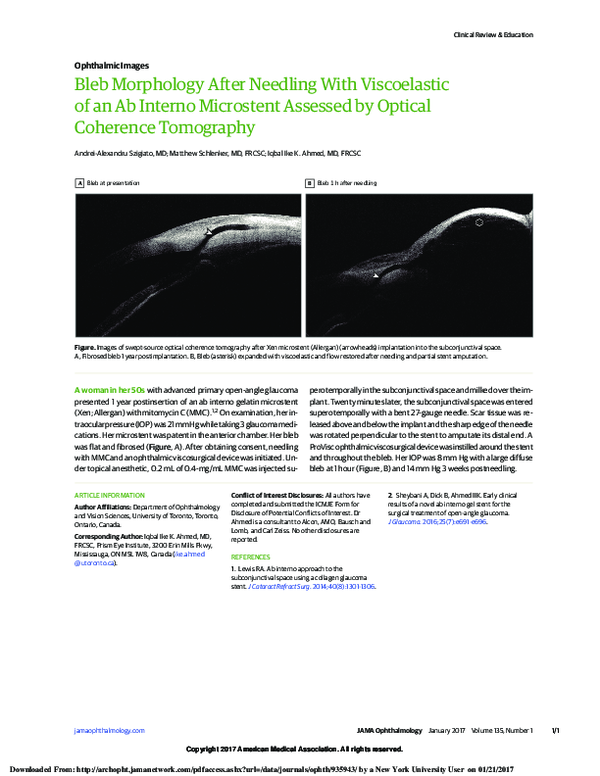 (PDF) Bleb Morphology After Needling With Viscoelastic of an Ab Interno ...